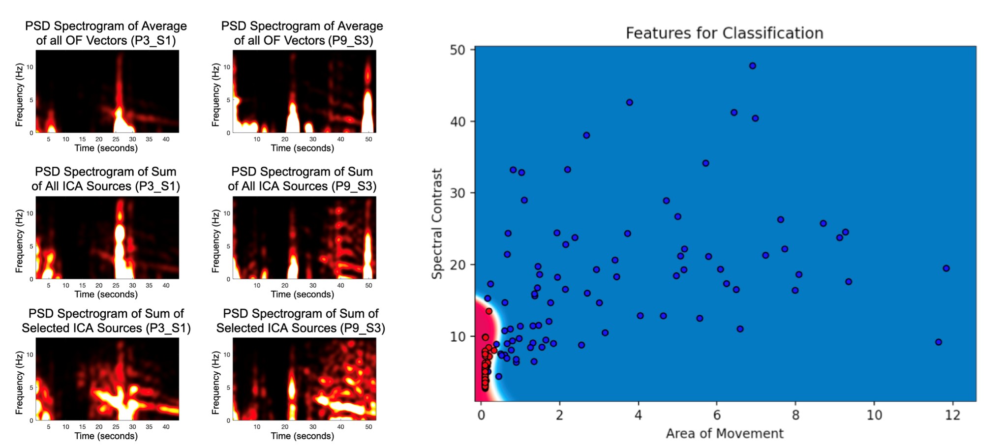 A Novel Approach To Automatic Seizure Detection Using Computer Vision And Independent Component 